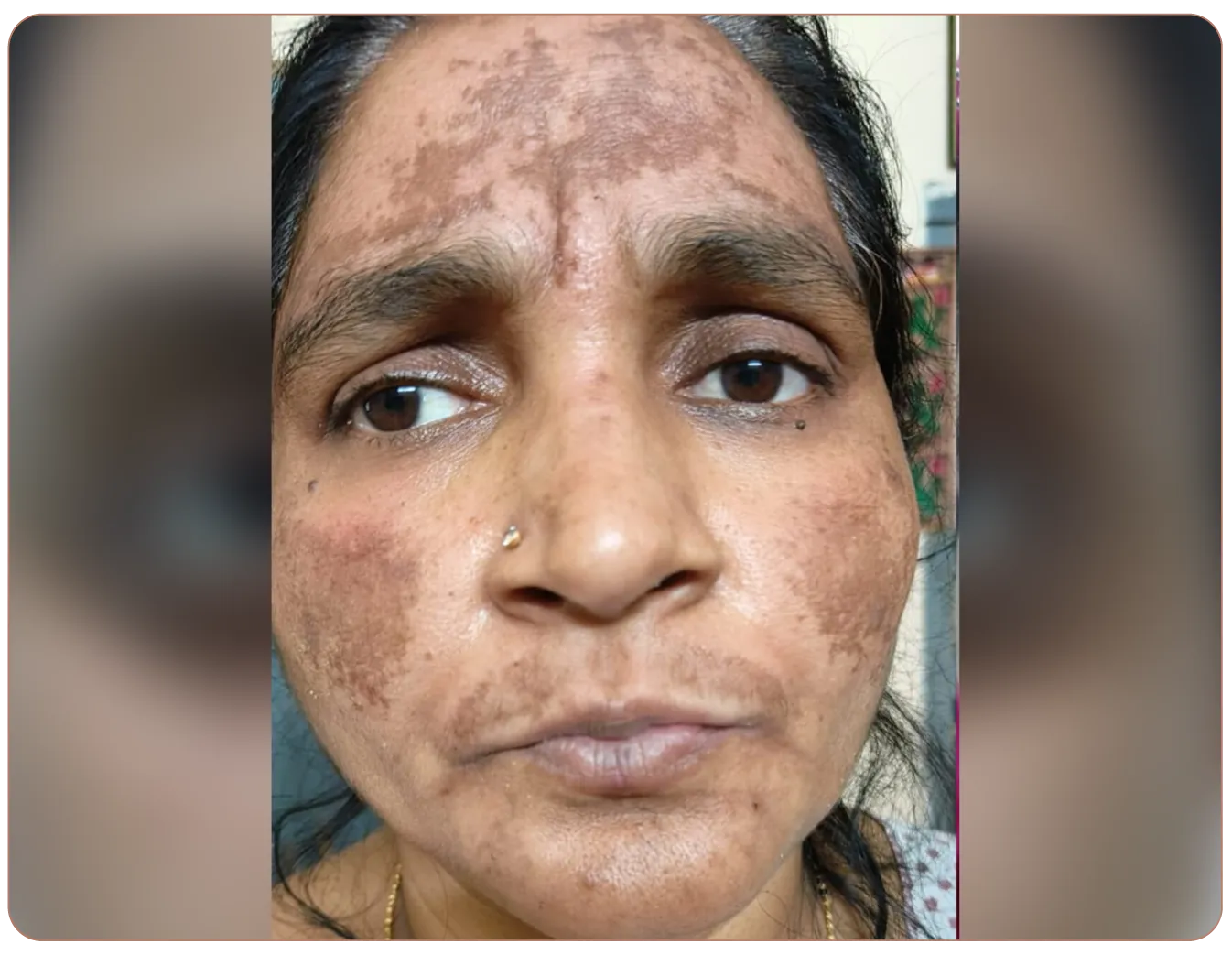 Kolors Hair and Skin - Pigmentation Images