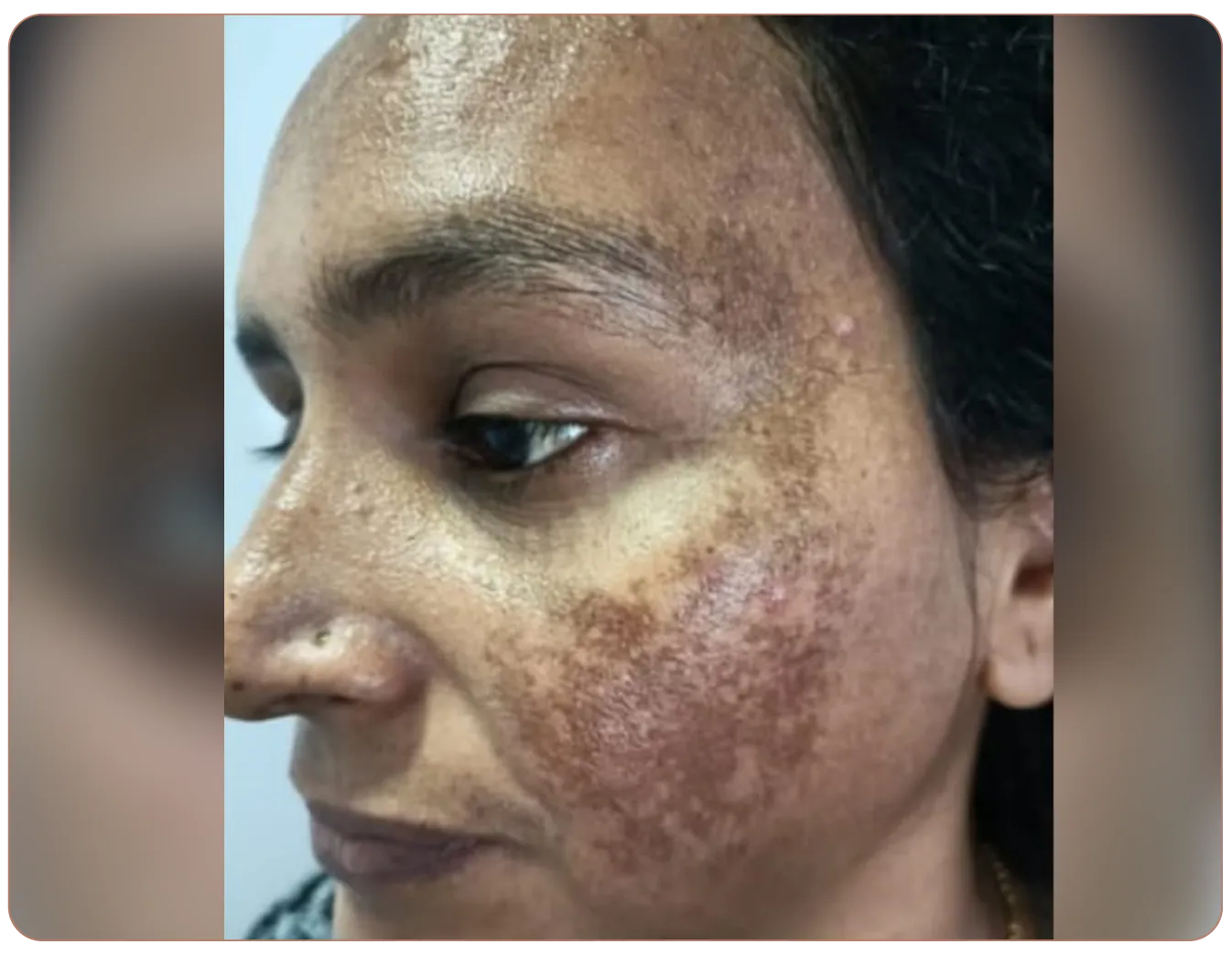 Kolors Hair and Skin - Pigmentation Images