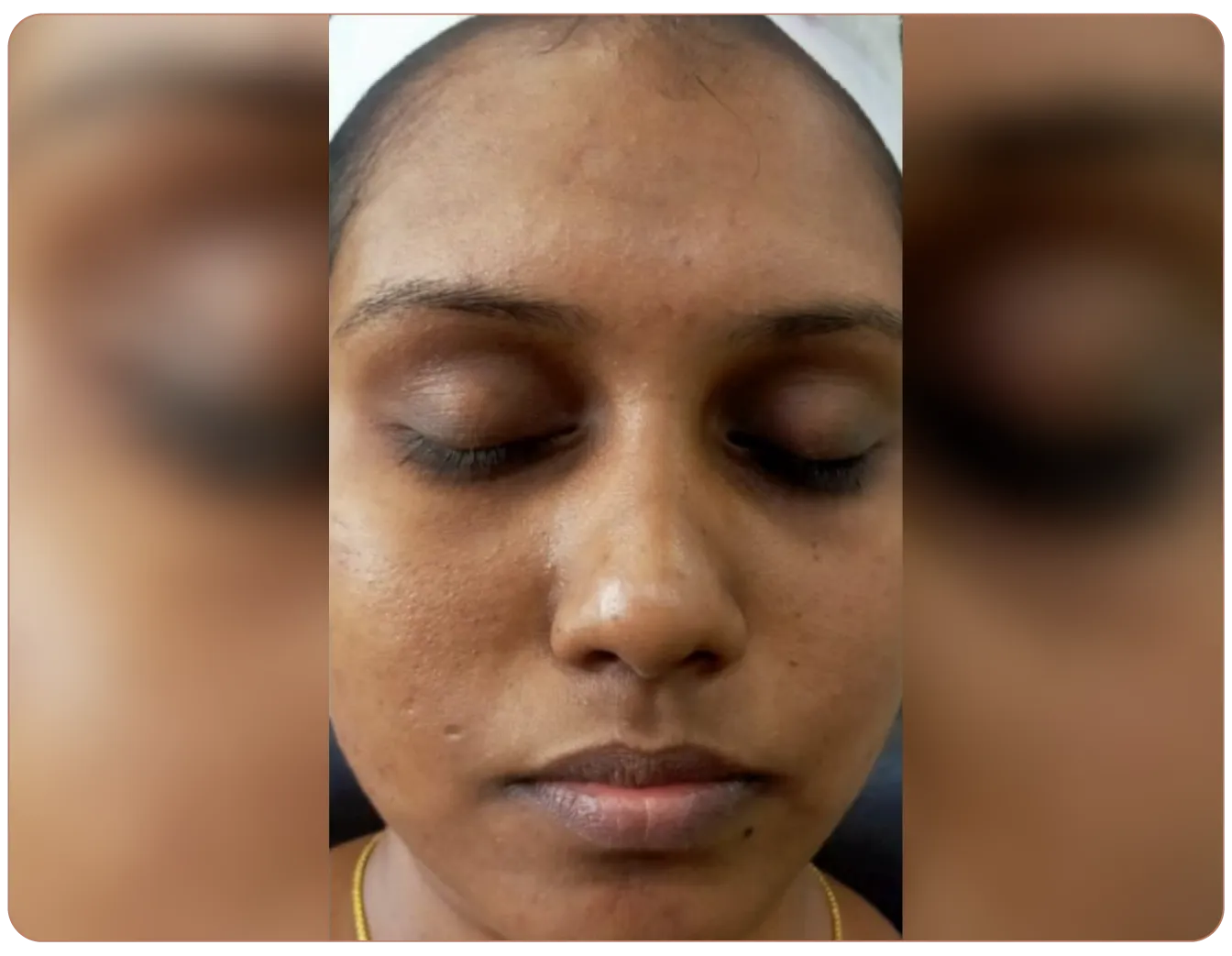 Kolors Hair and Skin - Skin Lightening Images