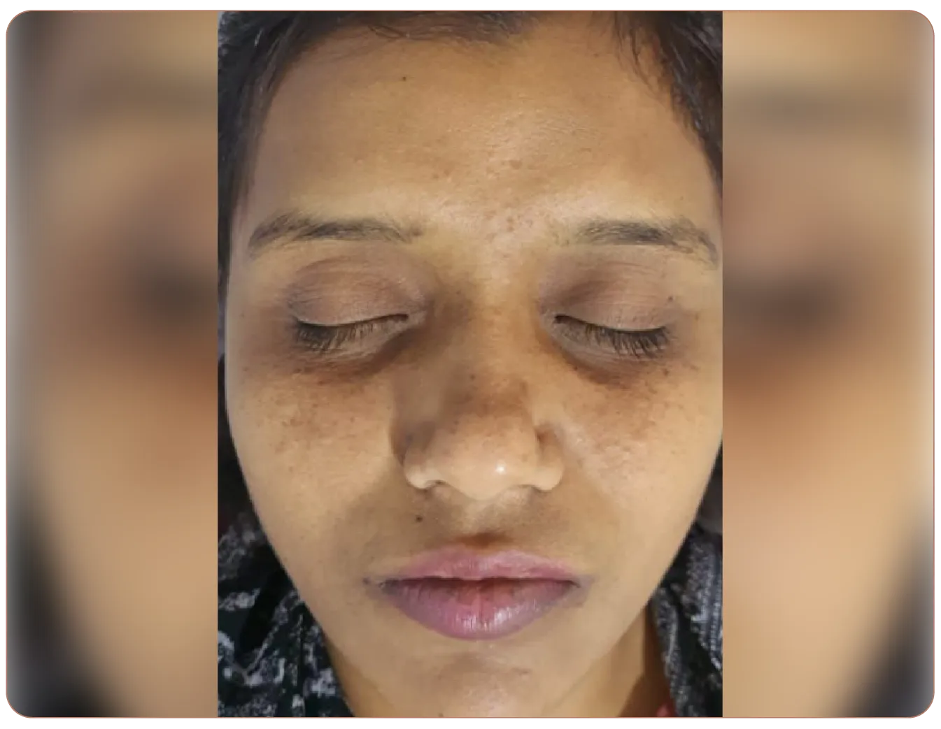 Kolors Hair and Skin - Skin Lightening Images