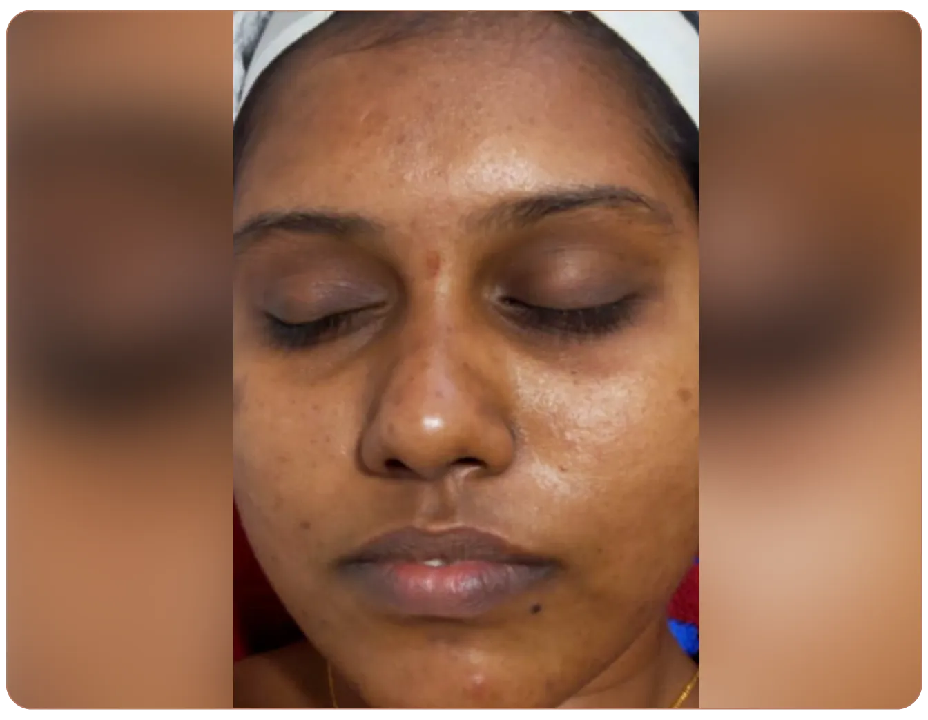 Kolors Hair and Skin - Skin Lightening Images