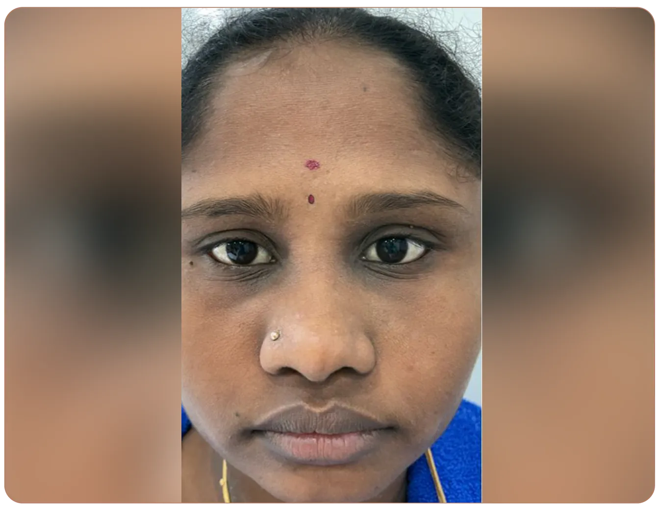 Kolors Hair and Skin - Skin Lightening Images