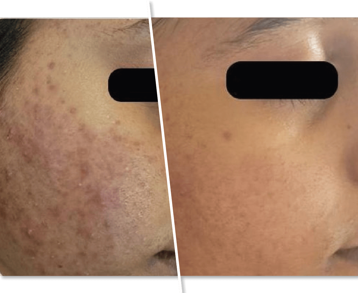 Best Skin Care Treatment Clinics and Services at Kolors